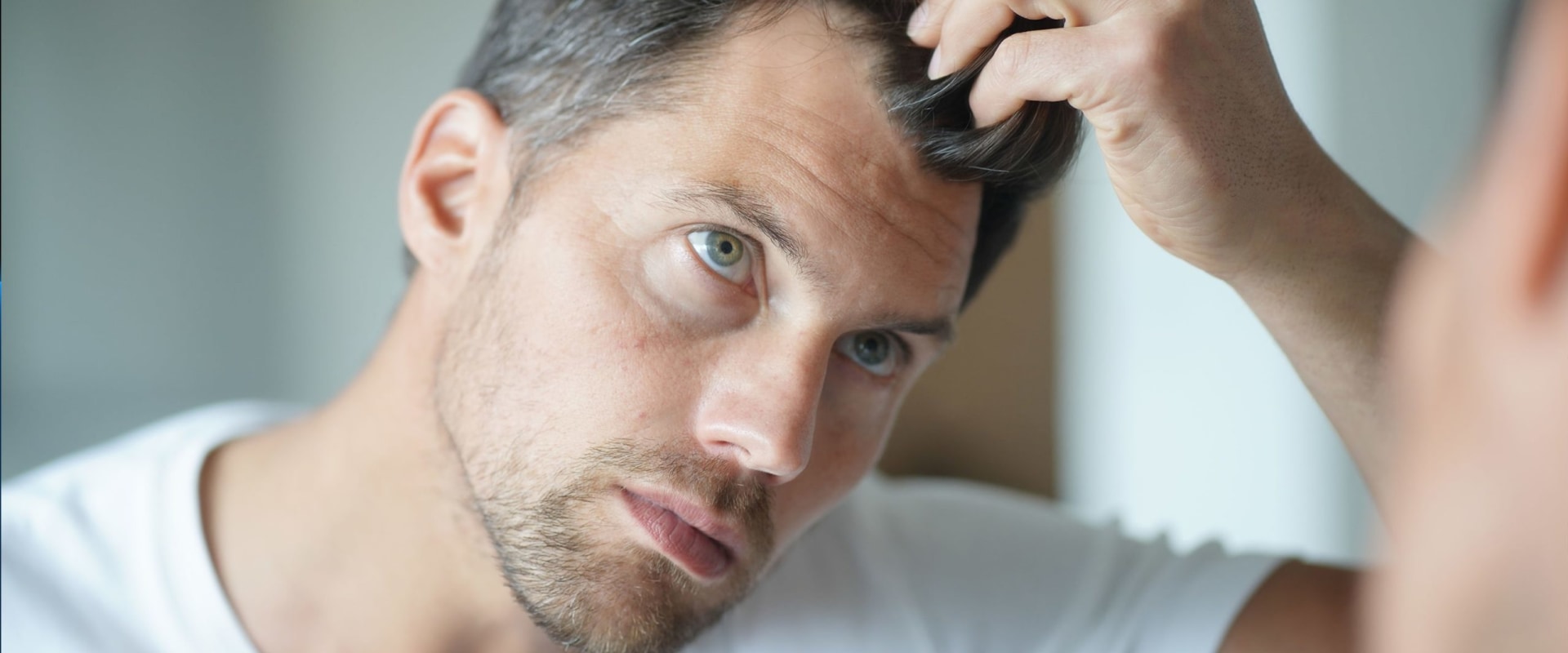 Understanding Hormonal Changes and Male Pattern Baldness